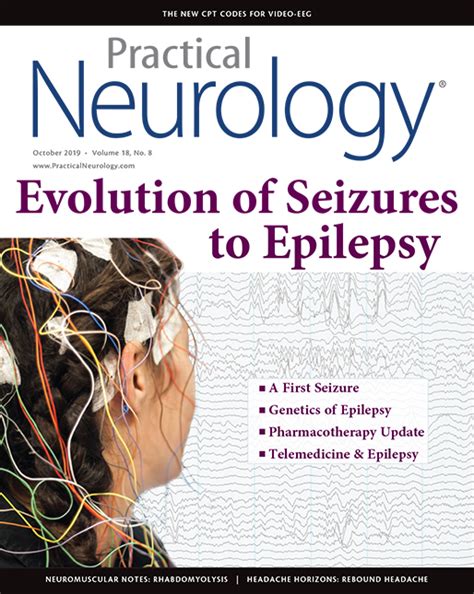 Electroencephalography Cpt Code General News Aset News