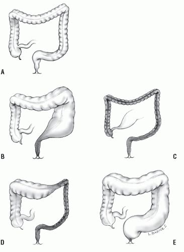 C3 Ff1 Abdominal Key
