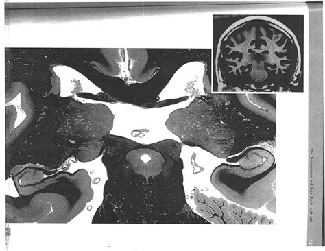6 32 Brain Slice Diagram Quizlet