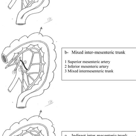 Functional Role Of The Inter Mesenteric Trunk Download Scientific Diagram