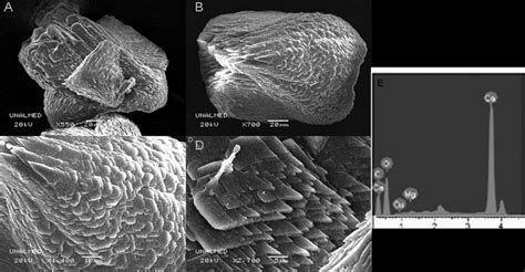 Scanning Electron Microscopy Of Calcium Carbonate Crystals Harvested