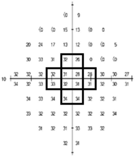 Importance Of Pattern Standard Deviation Of Humphrey 10 2 Visual Field