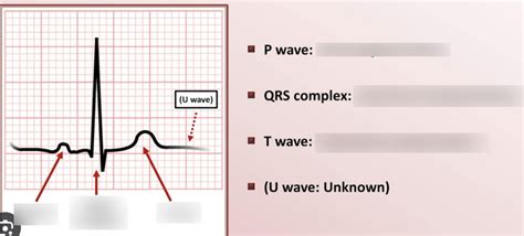 Anatomy Lab Week 3 Ekg Diagram Diagram Quizlet