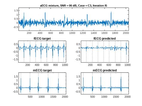 signal source separation using w net architecture