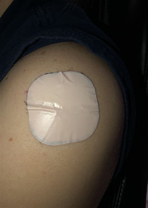 I M On The Xulane Patch And I Was Wondering If It Was Normal For It To