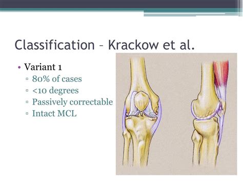 Ppt Tka In The Valgus Knee Powerpoint Presentation Free Download