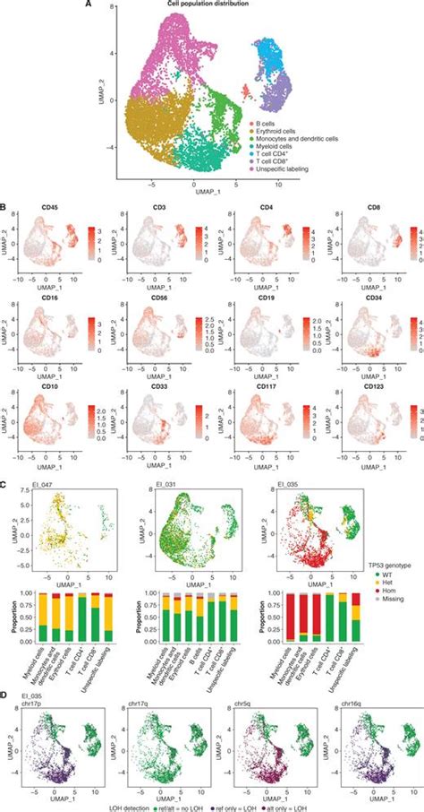 adult low hypodiploid acute lymphoblastic leukemia emerges from