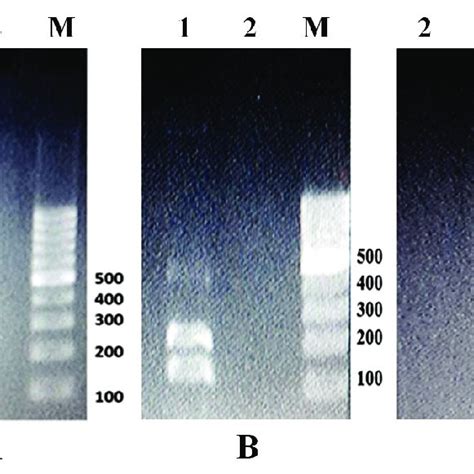 A Plasmid Extraction 1 Extracted Plasmid 2 1 Kb Dna Ladder B