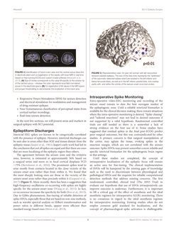 BrainComputer Interface BCI Applications In Mapping Of Epileptic Brain Networks Based On