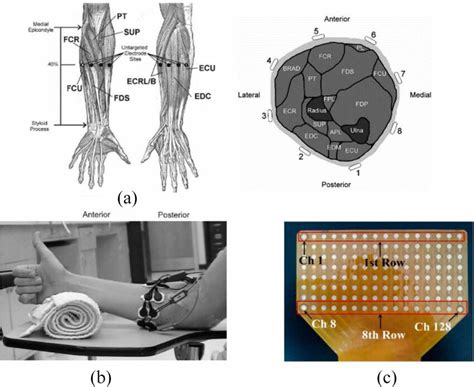 Surface Electromyography A Relationship Between Gesture And Forearm Download Scientific