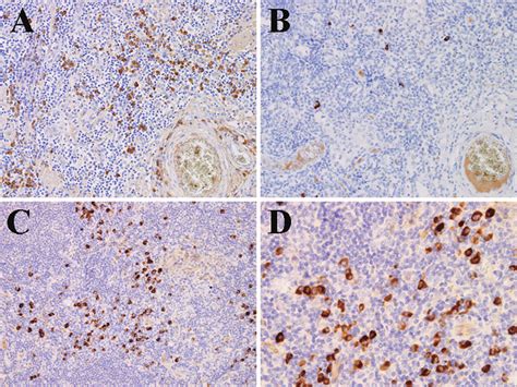 Figure2 Light Microscopic Examination Of A Lymph Node Biopsy Specimen Download Scientific