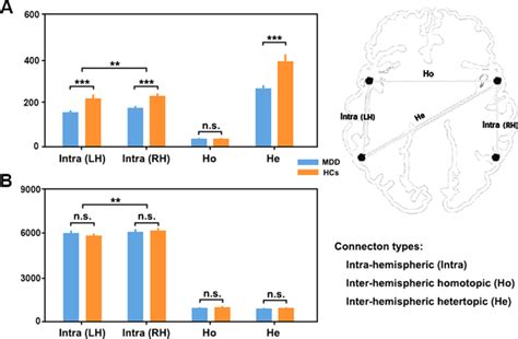 主要抑郁症患者的功能和结构性半球脑网络的connectome分析。 translational psychiatry x mol