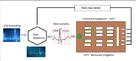 Figure From An Automated ECG Beat Classification System Using Convolutional Neural Networks