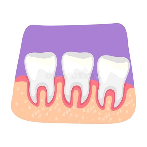 Sticker Gingivitis Stock Illustrations 15 Sticker Gingivitis Stock