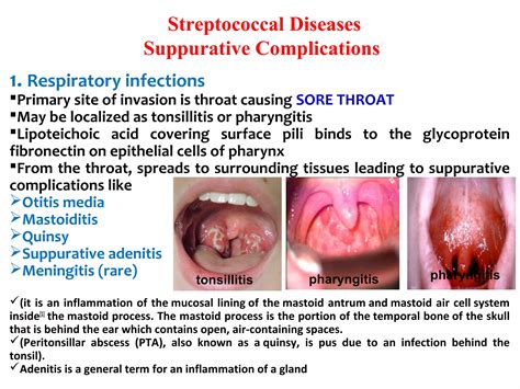 Genus Streptococcus Ppt
