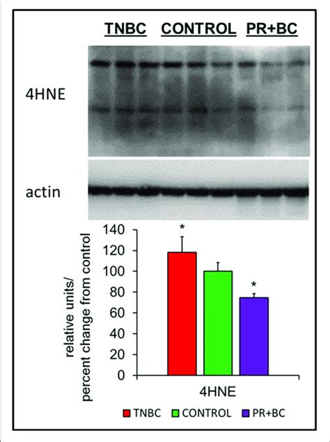 Levels Of 4 Hydroxy 2 Nonenal 4 Hne In The Hippocampal Tissues Of