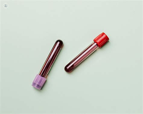 Immunoglobulin E Analysis What Is It Symptoms And Treatment Top Doctors