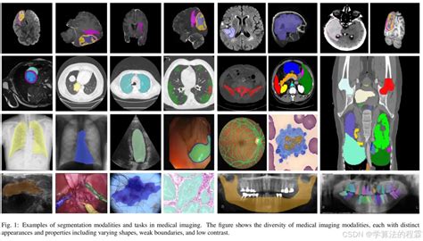 Medical Image Analysis：医学图像分割最新进展综述 Recent Advances In Medical Imaging