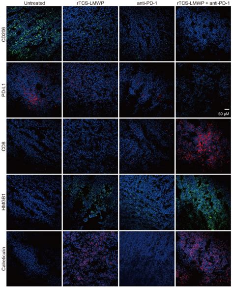 The Immunofluorescence Staining Of Cd206 Pd L1 Cd8 Hmgb1 And