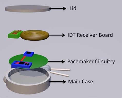 Pacemaker With Wireless Charging Capabilities