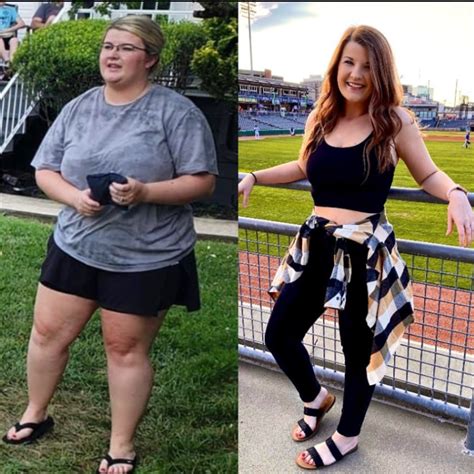 20 Real Intermittent Fasting Before And After Photos