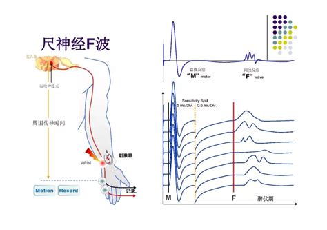 幻灯有约：肌电图基础