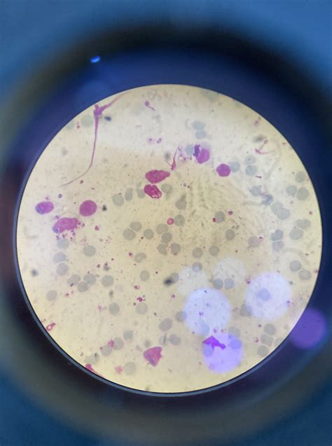 Papa Object Detection Model By Leish