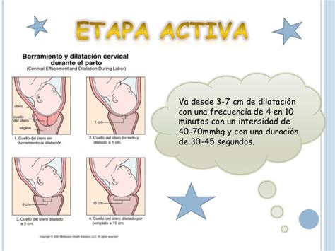 Las Fases Del Parto Dilatación Activa 3 Fases Del Parto Xaky