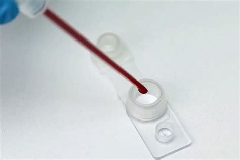 Blood Plasma Separator Blood And Plasma Separation Bps