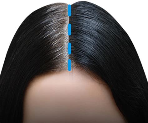 Buy Xcellerate 35 Hair Growth Serum Get Thicker Hair Thin Lizzy