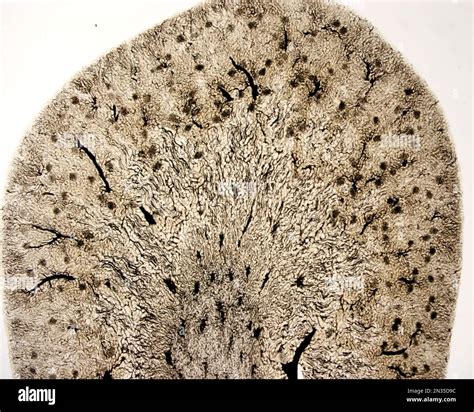 The Study Of An Organ Microvasculature Usually Implies The Filling Of