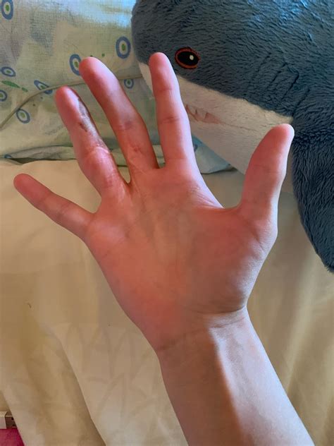 Is My Hand Gay Ive Been Dying To Know Ever Since I Found This Sub R