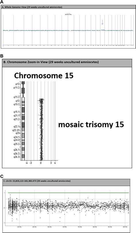 A B And C Acgh Analysis On The Dna Extracted From Uncultured Download Scientific Diagram
