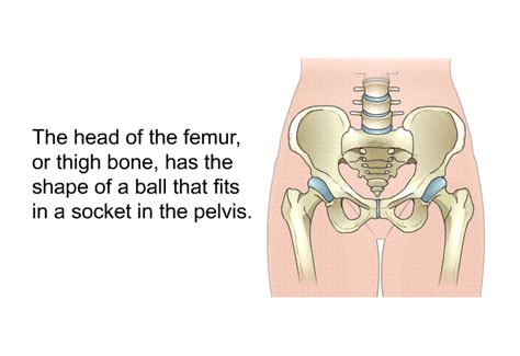 Hip Replacement Surgery Preventing Post Op Complications