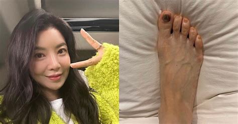 윤세아 까맣게 멍든 발톱 무슨 일 모든 일에는 대가가 따른다