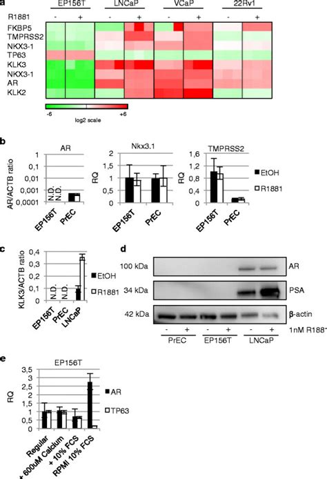 Expression Data Of Ep156t And Prec Cells A Agilent Microarray Gene