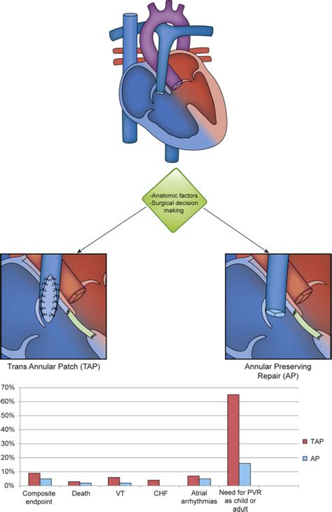 Outcomes In Young Adults With Tetralogy Of Fallot And Pulmonary Annular