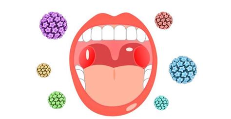 口腔咽喉里感染了hpv，薇润提醒不洁行为成主要诱因！陈明口咽酸酐病毒细胞新浪新闻