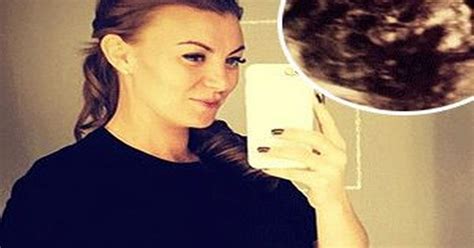 Billi Mucklow Shares First Scan As Fans Speculate Over The Sex Of Her