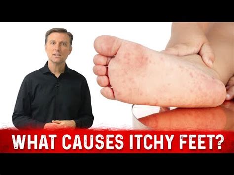 What Causes Itchy Feet Youtube