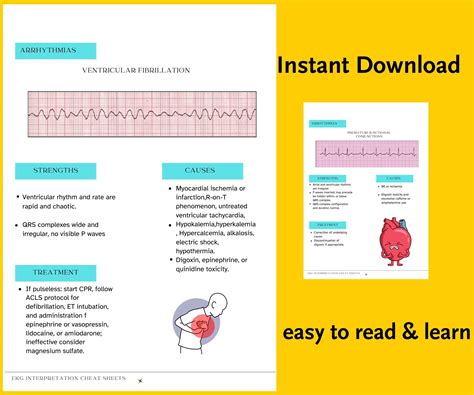 The Best Ekg Interpretation And Heart Arrhythmias Cheat Sheet Dysrhythmias Interpreting Ekg Ekg