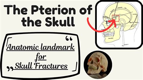 Pterion Of The Skull Anatomy Importance And Clinical Significance
