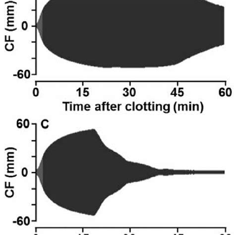Representative Rotational Thromboelastometry Tracings Recorded By Use