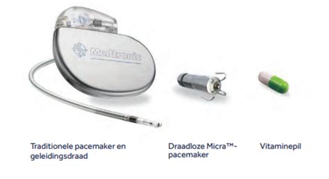 Cardioloog Boersma Plaatst Kleinste Draadloze Pacemaker Ter Wereld St