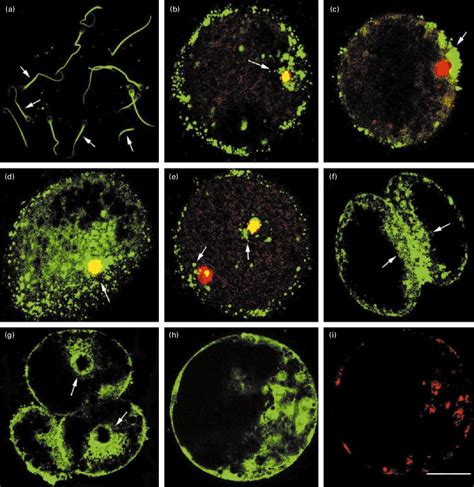 Figure 2 From Translocation Of Active Mitochondria During Pig Oocyte