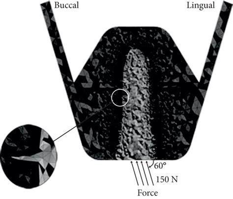 Cross Sectional Views Of The Symmetry Plane In The Meshed Model A