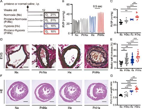 Figure 1 From Pristane Hypoxia Prihx Mouse As A Novel Model Of Pulmonary Hypertension