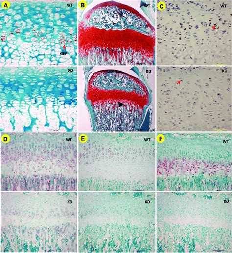 Gep Knockdown Kd Leads To A Sharp Reduction Of Chondrogenic Markers