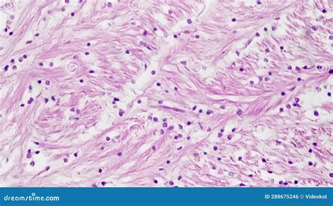 Section Of Human Sensory Cortex Filmed Under Microscope 400x On Bright Field Stock Footage