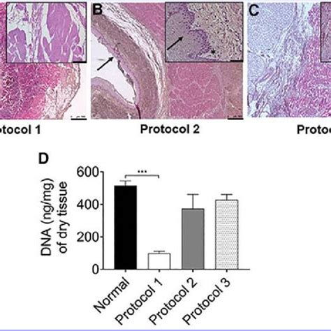 Comparison Of Different Decellularization Protocols A Hande Staining